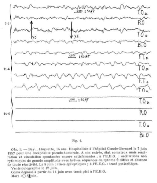 L’immortalité, une vieille utopie réveillée par le transhumanisme ...